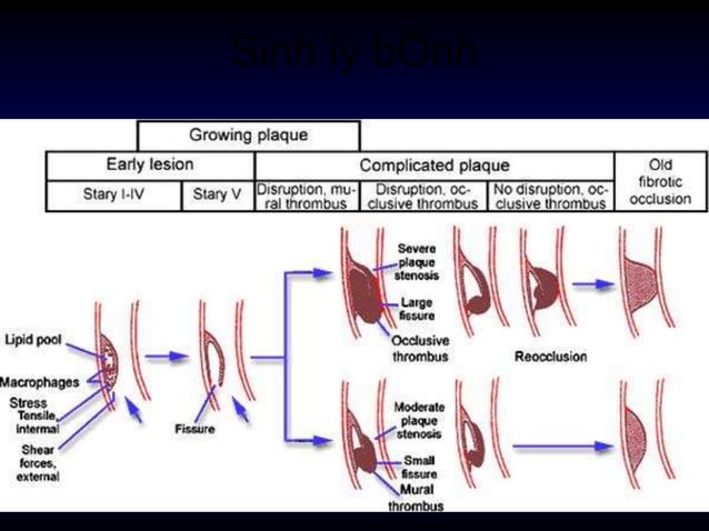 NMCT Cap. TS BS Hoai 2020.ppt