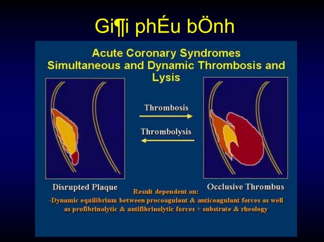 NMCT Cap. TS BS Hoai 2020.ppt