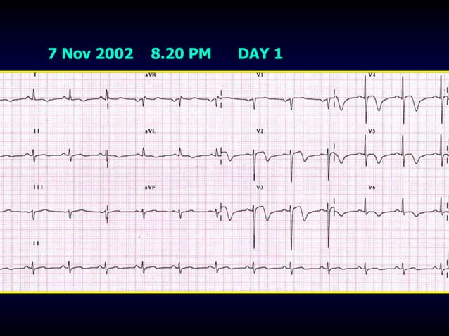 NMCT Cap. TS BS Hoai 2020.ppt