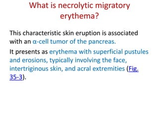 Necrolytic Migratory Erythema Face