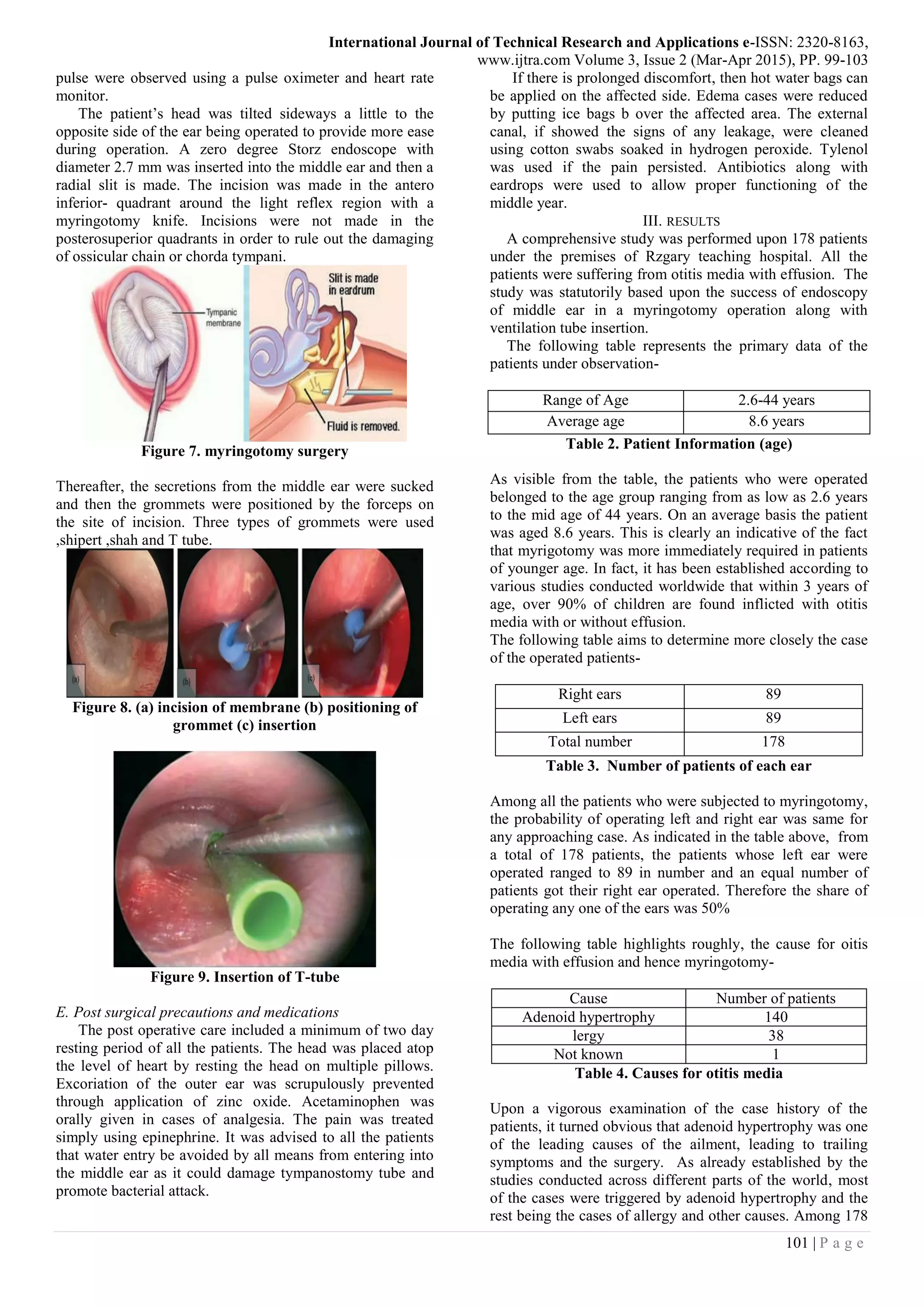 ENDOSCOPIC INSERTION OF TYMPANOSTOMY TUBE IN CHILDREN | PDF