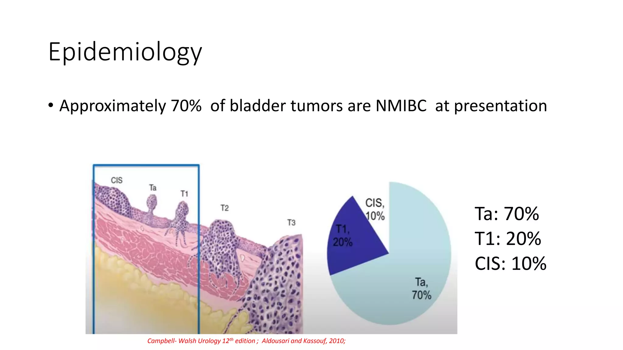 Nmibc, NON MUSCLE INVASIVE BLADDER CANCER | PPTX