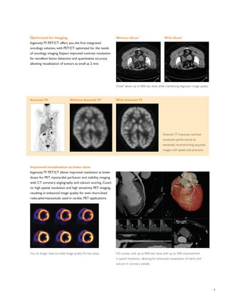 Nm petct ingenuity_tf_petct_overview | PDF