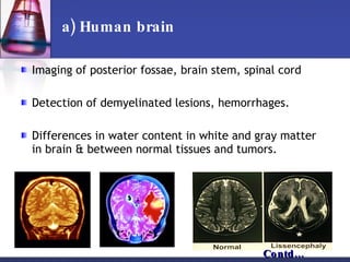 Nmr Spectroscopy In B Iology | PPT