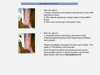 DermaWound for hard to heal woundcare | PDF | First Aid | Injuries