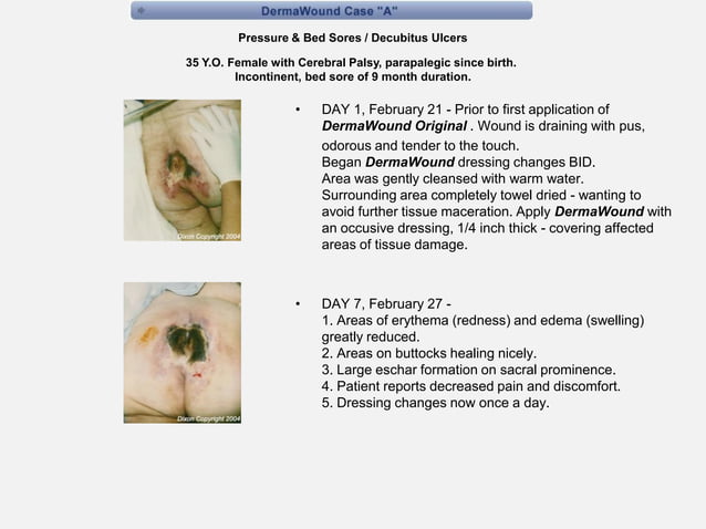 DermaWound for hard to heal woundcare | PDF | First Aid | Injuries