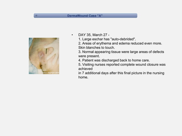 DermaWound for hard to heal woundcare | PDF | First Aid | Injuries