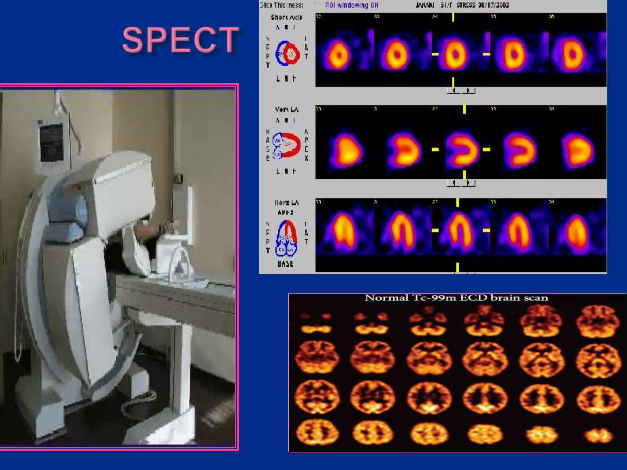 Planning of Nuclear Medicine Facility | PPTX