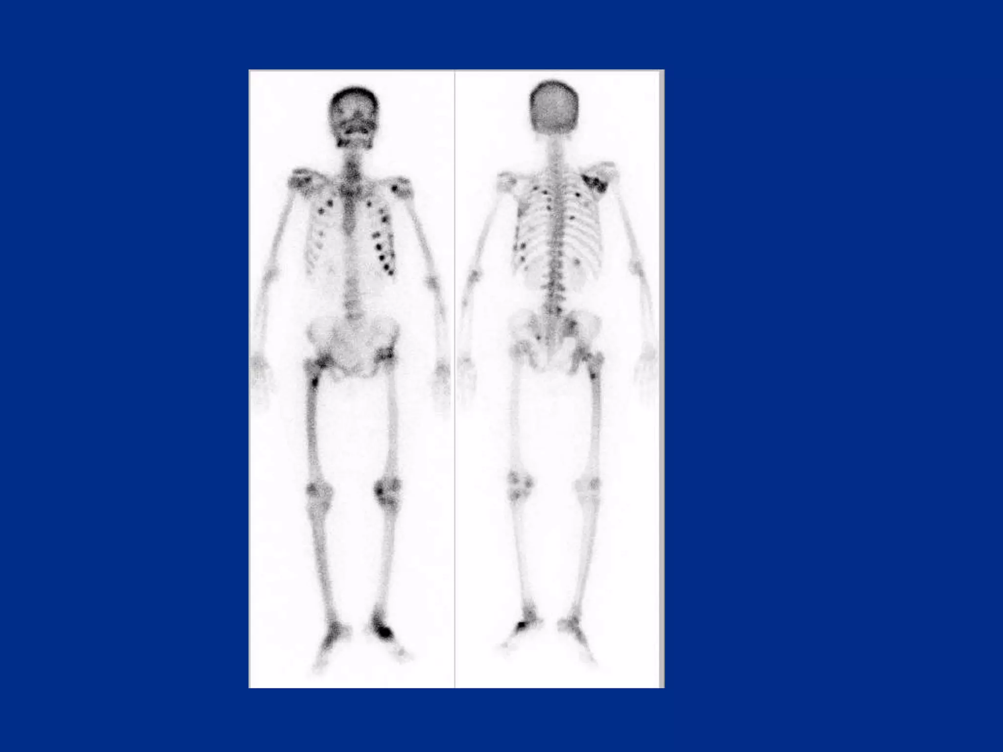 Planning of Nuclear Medicine Facility | PPTX