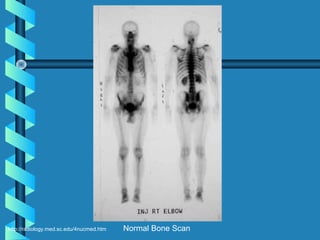 Nmt 631 2016_introduction_to basics_of_nuclear_medicine_procedures (3 ...