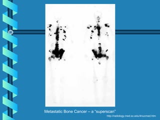 Nmt 631 2016_introduction_to basics_of_nuclear_medicine_procedures (3 ...