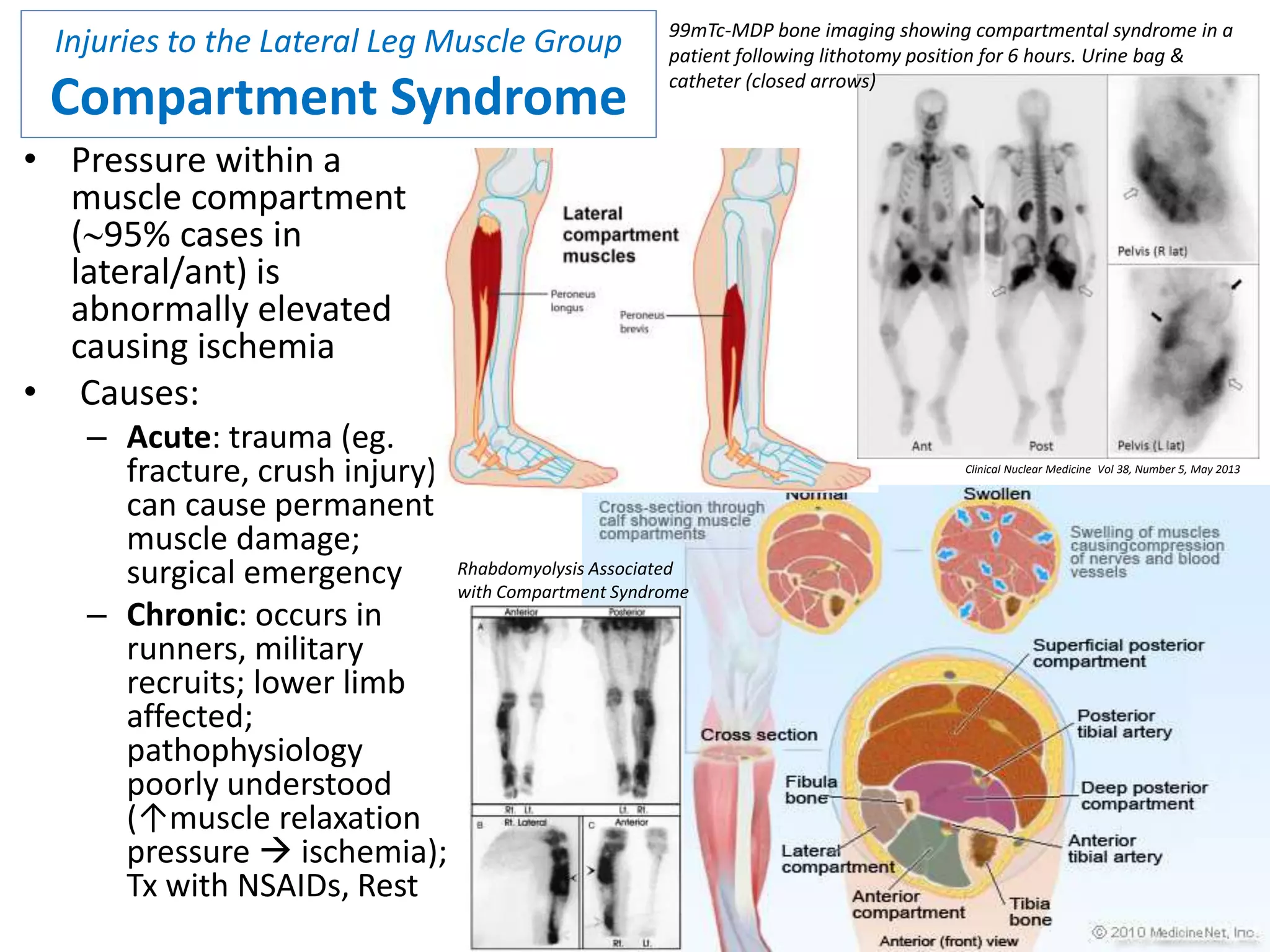Nmt631 msk lower extremity pathology | PPTX | Death, Injury, or ...