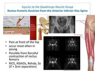 Nmt631 msk lower extremity pathology | PPTX | Death, Injury, or ...
