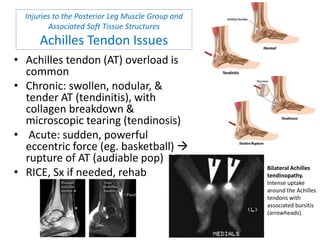 Nmt631 msk lower extremity pathology | PPTX