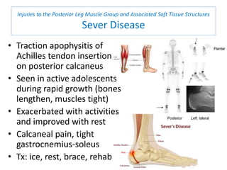 Nmt631 msk lower extremity pathology | PPTX