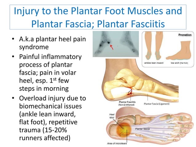 Nmt631 msk lower extremity pathology | PPTX | Death, Injury, or ...