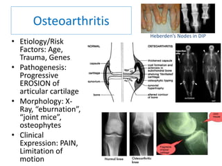Nmt631 msk lower extremity pathology | PPTX