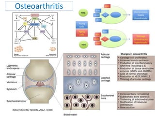 Nmt631 msk lower extremity pathology | PPTX
