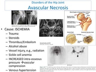 Nmt631 msk lower extremity pathology | PPTX
