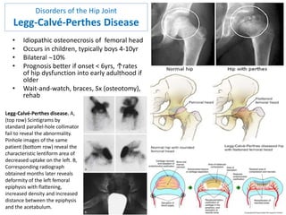 Nmt631 msk lower extremity pathology | PPTX