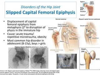 Nmt631 msk lower extremity pathology | PPTX