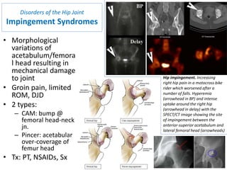 Nmt631 msk lower extremity pathology | PPTX
