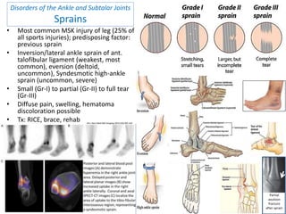 Nmt631 msk lower extremity pathology | PPTX
