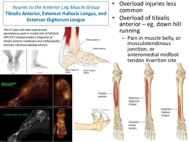 Nmt631 msk lower extremity pathology