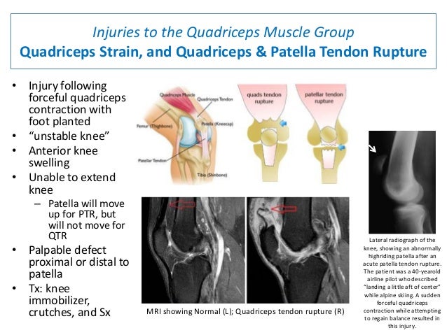 Nmt631 msk lower extremity pathology