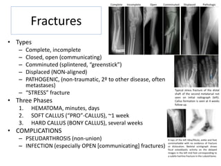 Nmt631 scintigraphy in common bone diseases | PPTX | Bone and Joint ...