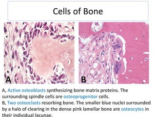 Nmt631 scintigraphy in common bone diseases | PPTX