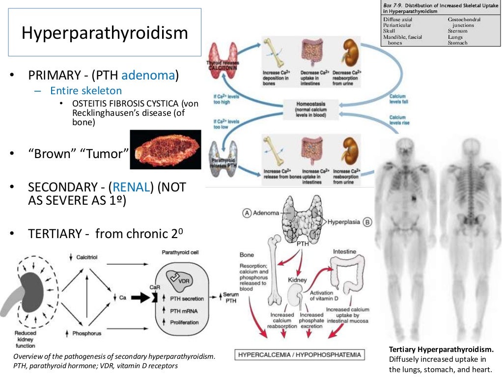 Nmt631 scintigraphy in common bone diseases