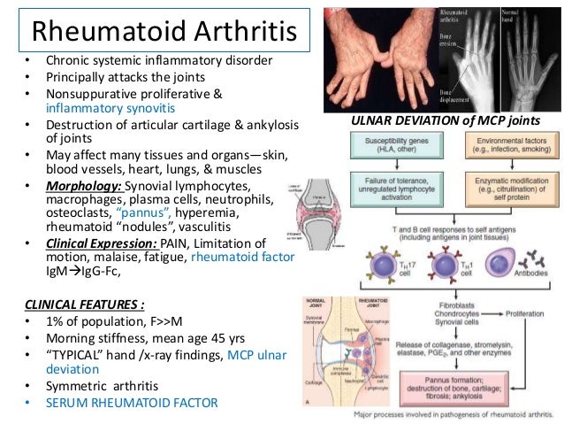 Nmt631 scintigraphy in common bone diseases