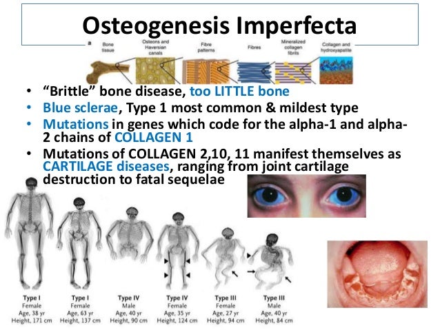 Nmt631 scintigraphy in common bone diseases