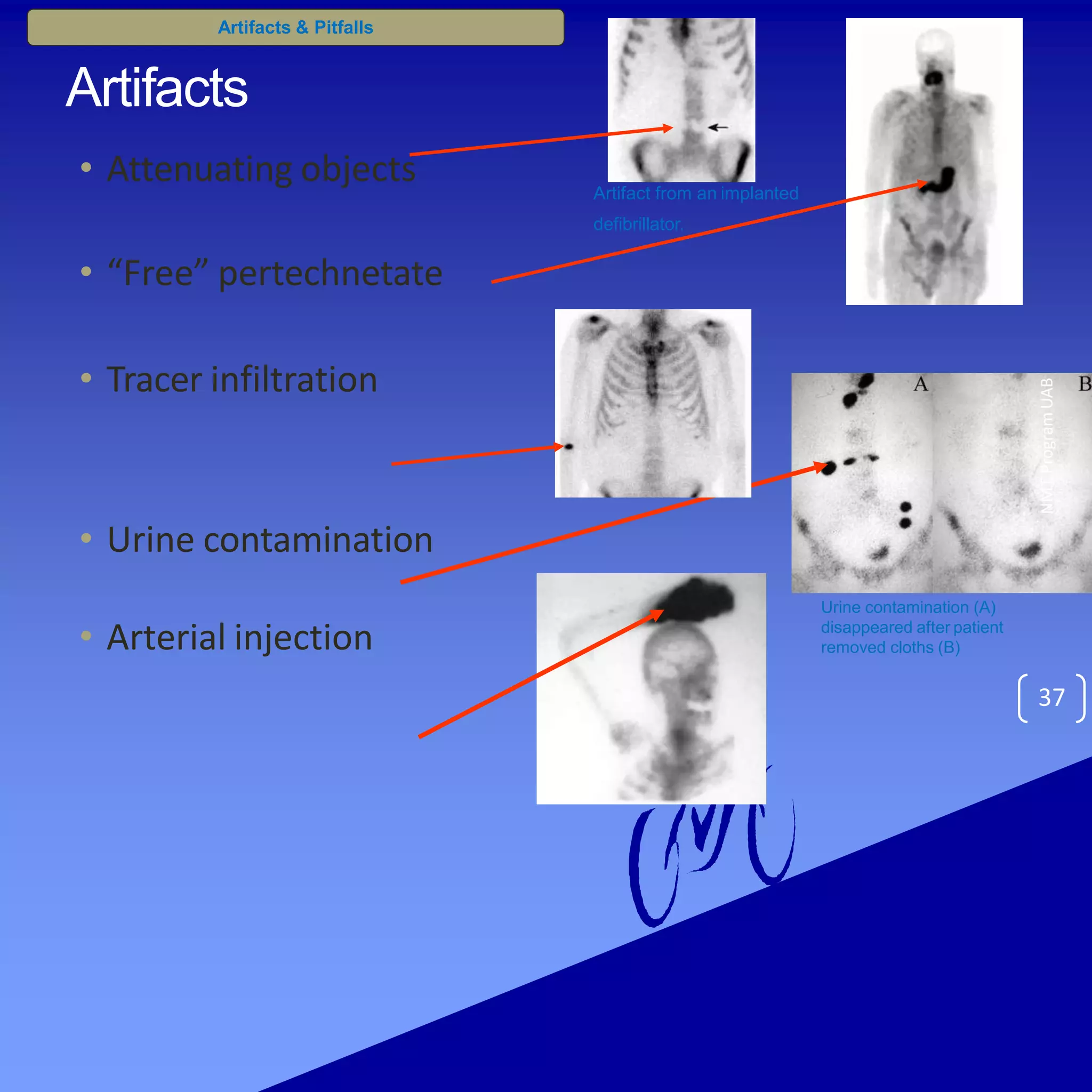 Skeleton systems examination in medical | PPTX