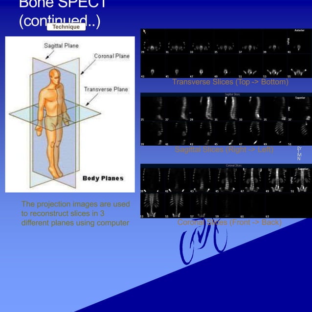 Skeleton systems examination in medical | PPTX