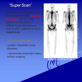 Skeleton systems examination in medical | PPTX
