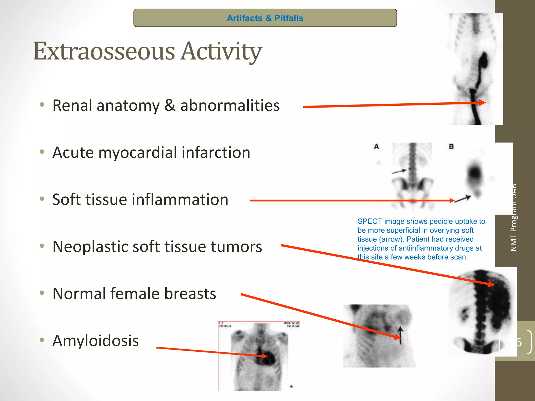 Anatomy And Physiology of Human skeletal system | PDF