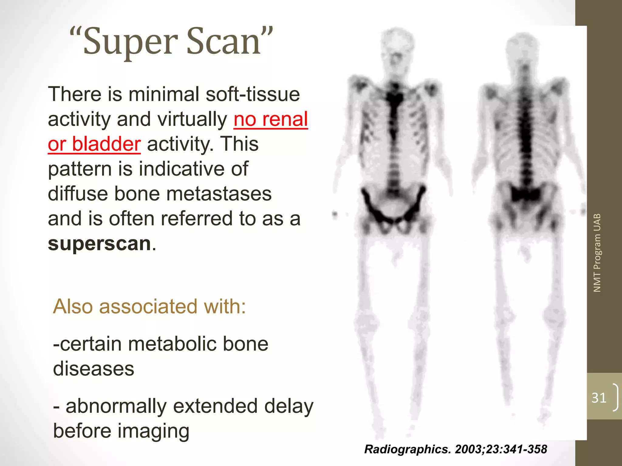 Nmt631 skeletal anat, phys, bone scinti principles | PPTX