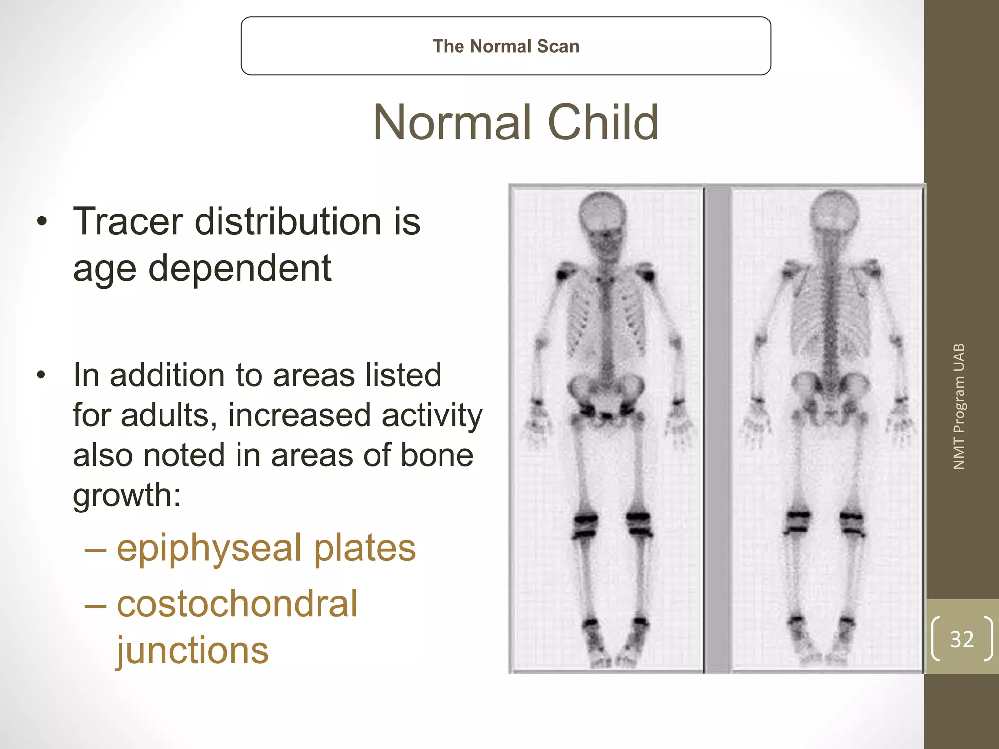 Nmt631 skeletal anat, phys, bone scinti principles | PPTX