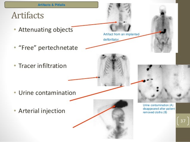 Nmt631 skeletal anat, phys, bone scinti principles