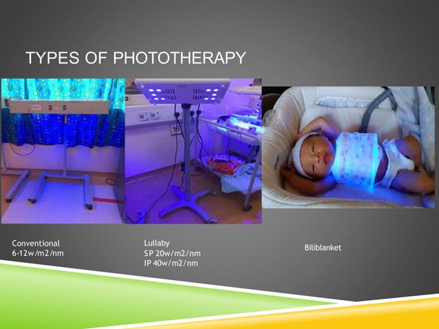 NNJ.pptx | Pregnancy | Reproductive Health