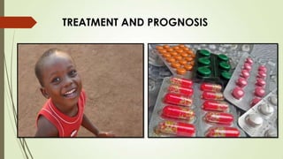 Noma (bacterial infections of oral cavity) | PPTX
