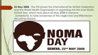 Noma (bacterial infections of oral cavity) | PPTX