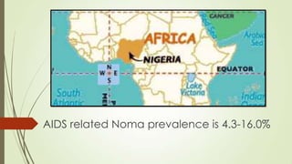 Noma (bacterial infections of oral cavity) | PPTX