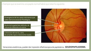 El nervio optico y sus alteraciones | PPTX
