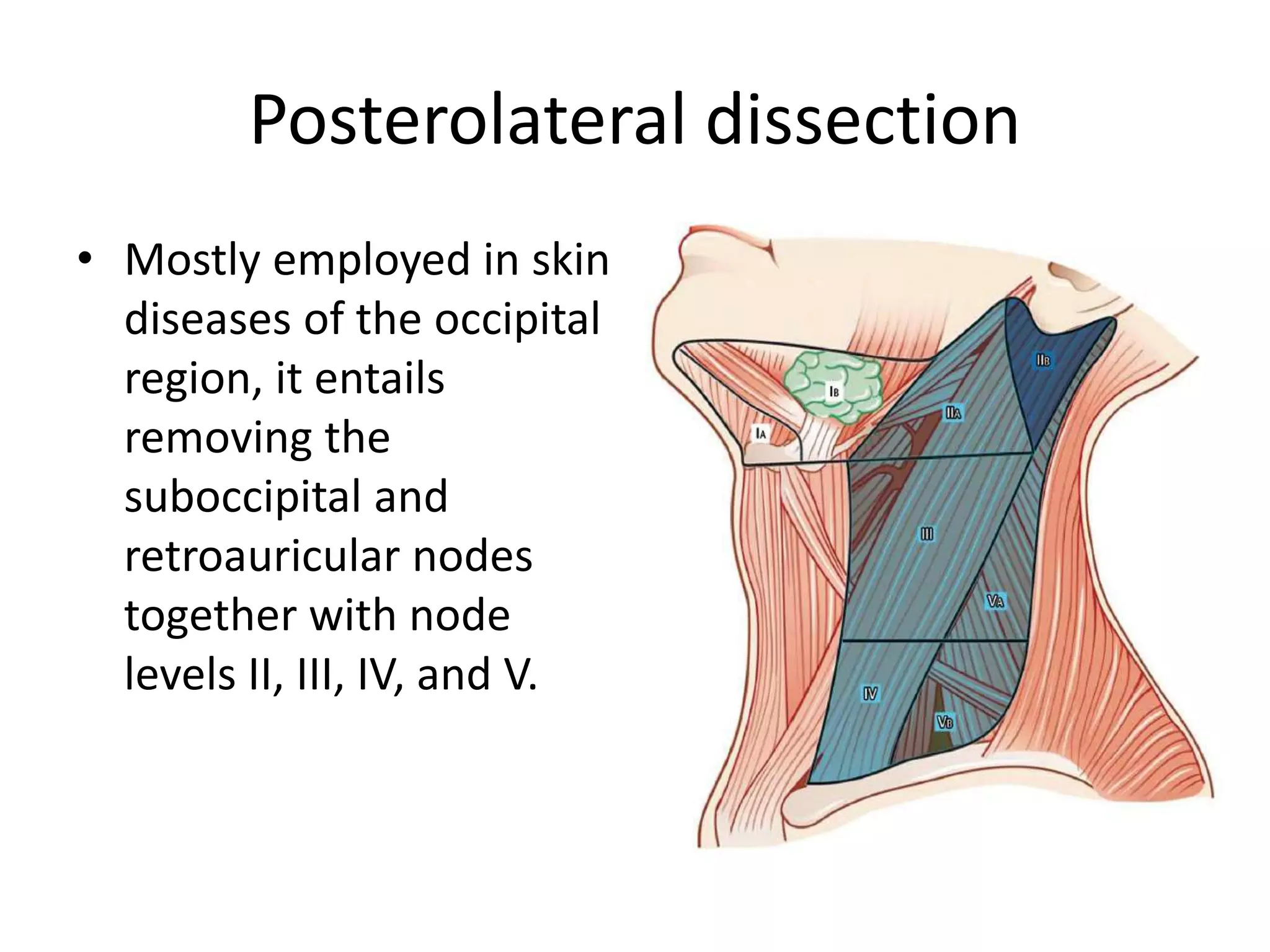 clinically N0 neck in oral cancer | PPTX