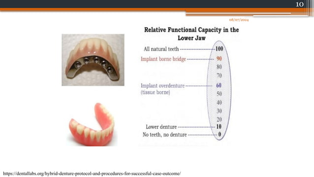 Hybrid Prosthesis...................pptx | Dental Health | Diseases and ...