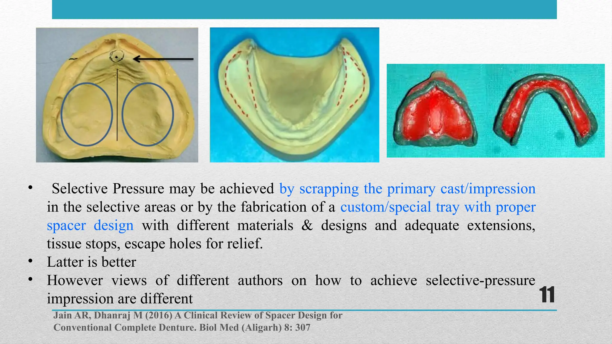 SPACER DESIGNS AND STOPPERS................ | PPTX