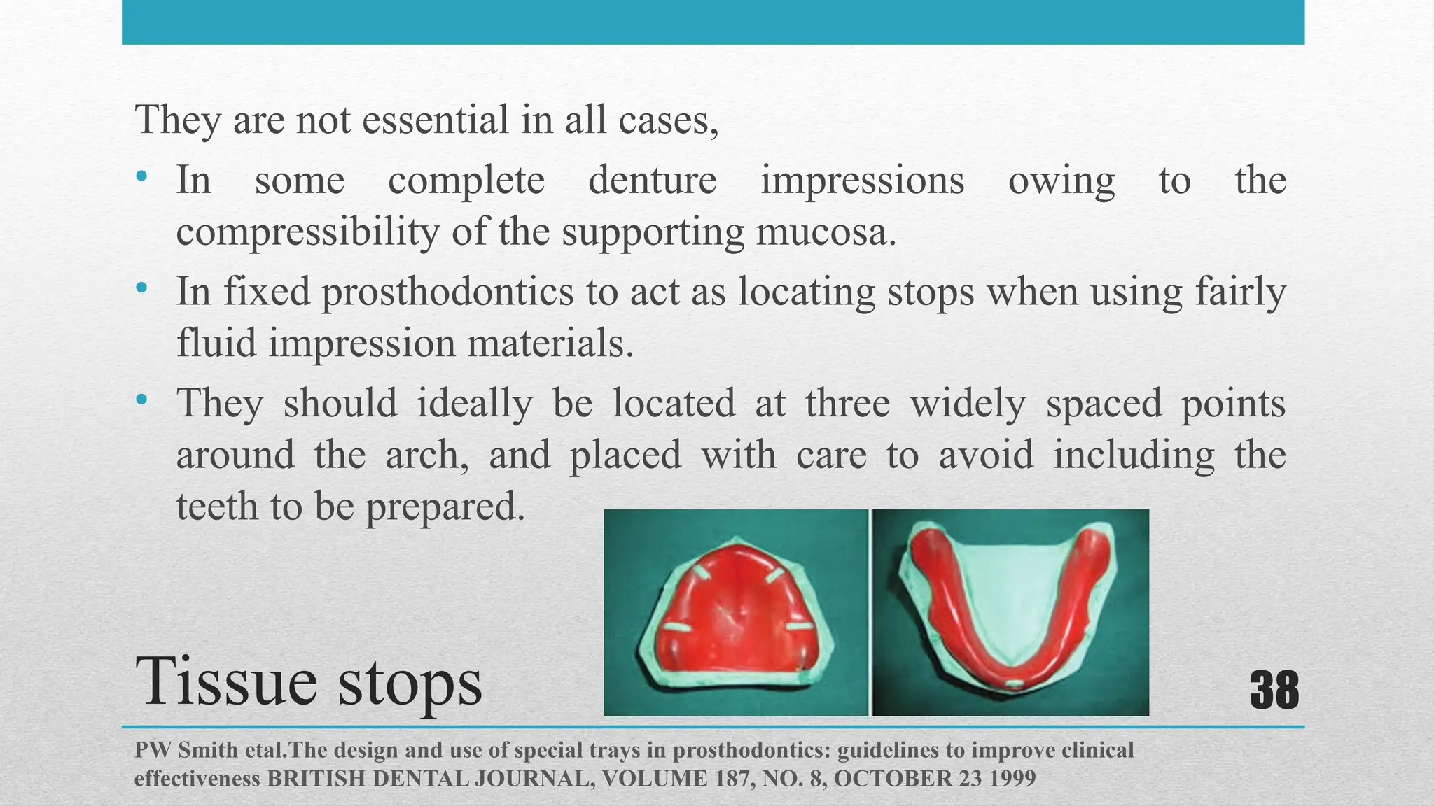 SPACER DESIGNS AND STOPPERS................ | PPTX